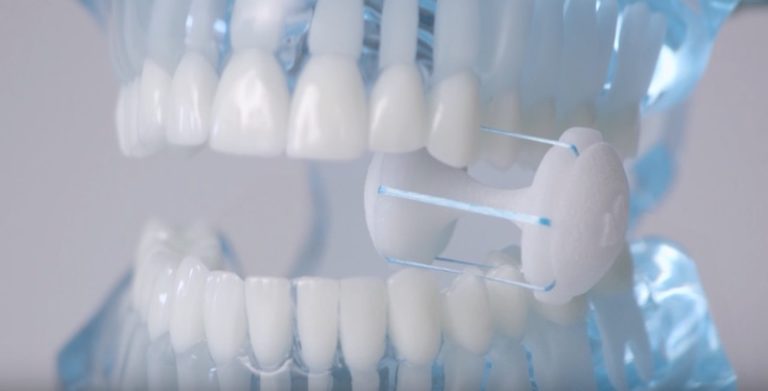 CrossFloss: The Hands-Free Flossing Revolution