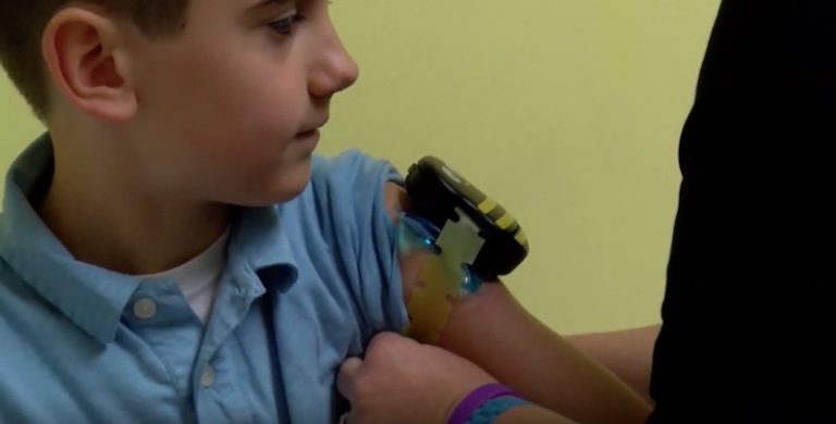 Buzzy: The Cute Pain Reliever for Injections