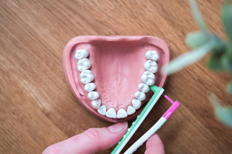 WingBrush: The Revolutionary Way to Clean Between Your Teeth